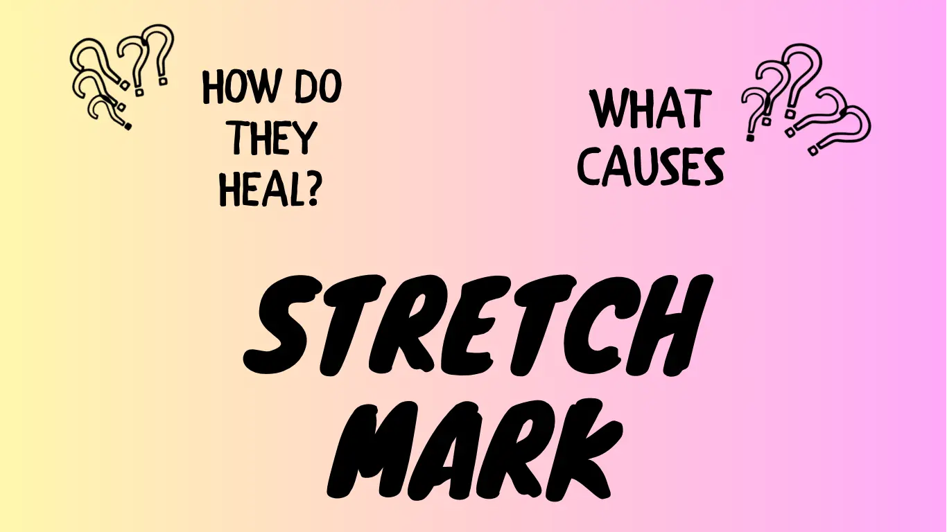 Stretch Marks: The Definite Way to Get Rid of This Problem - ChefTurko